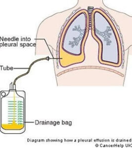 NOVATECH STERITALC ® – FR Medical
