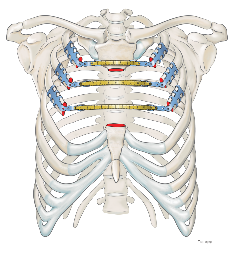 STRATOS™ – FR Medical